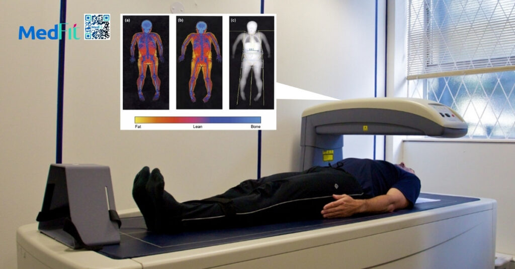 Máy InBody là gì và lợi ích khi đo chỉ số cơ thể bằng InBody - Phòng khám MedFit